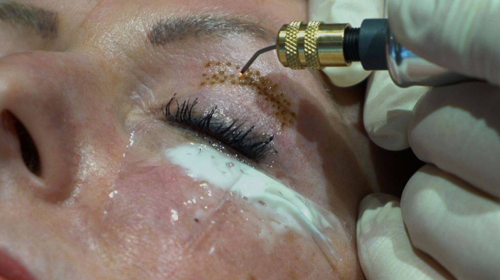 Fibro Blasting nz Wellington Kapiti lower hutt, anti wrinkles